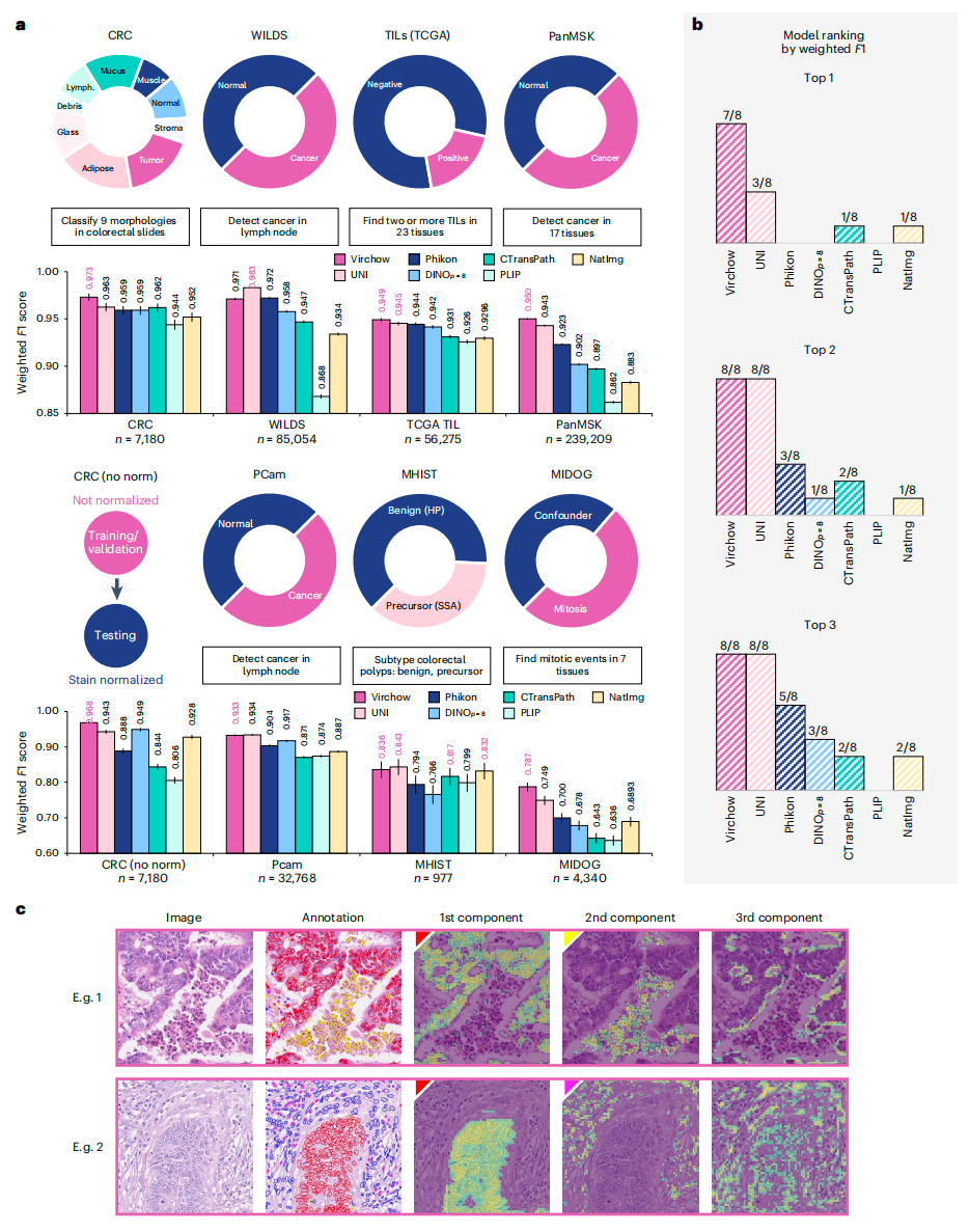 Nat Med | Paige、微软携手发表迄今最大的计算病理学基础模型Virchow，为AI癌症病理学树立新标杆 – SEQ.CN